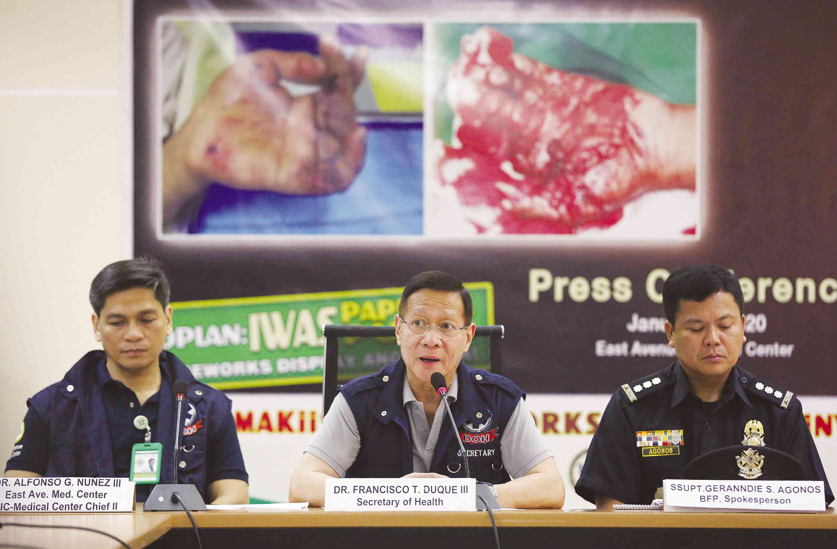 ‘Oxymoronic’: Most injuries due to legal fireworks–DOH | Cebu Daily News