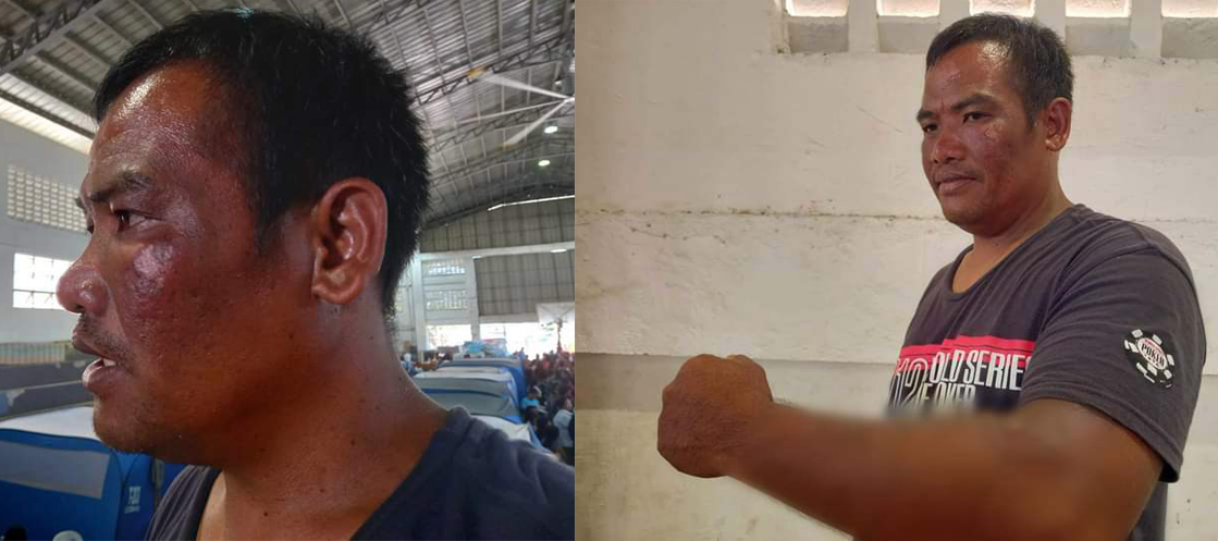 VOLUNTEER LOOC FIRE: Volunteer helps fight Looc fire, hurt