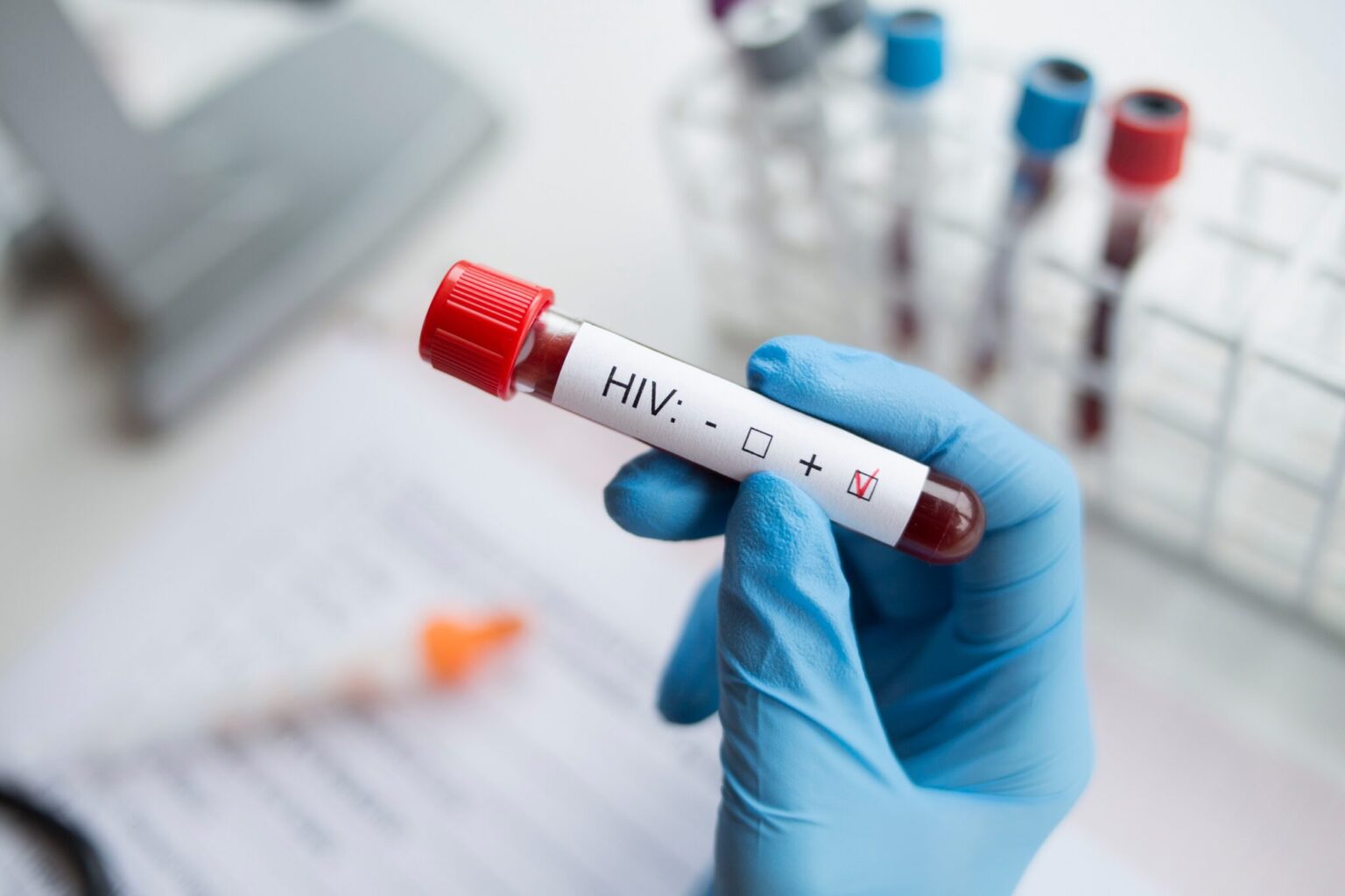 Living with HIV: DOH offers free services in Manila event