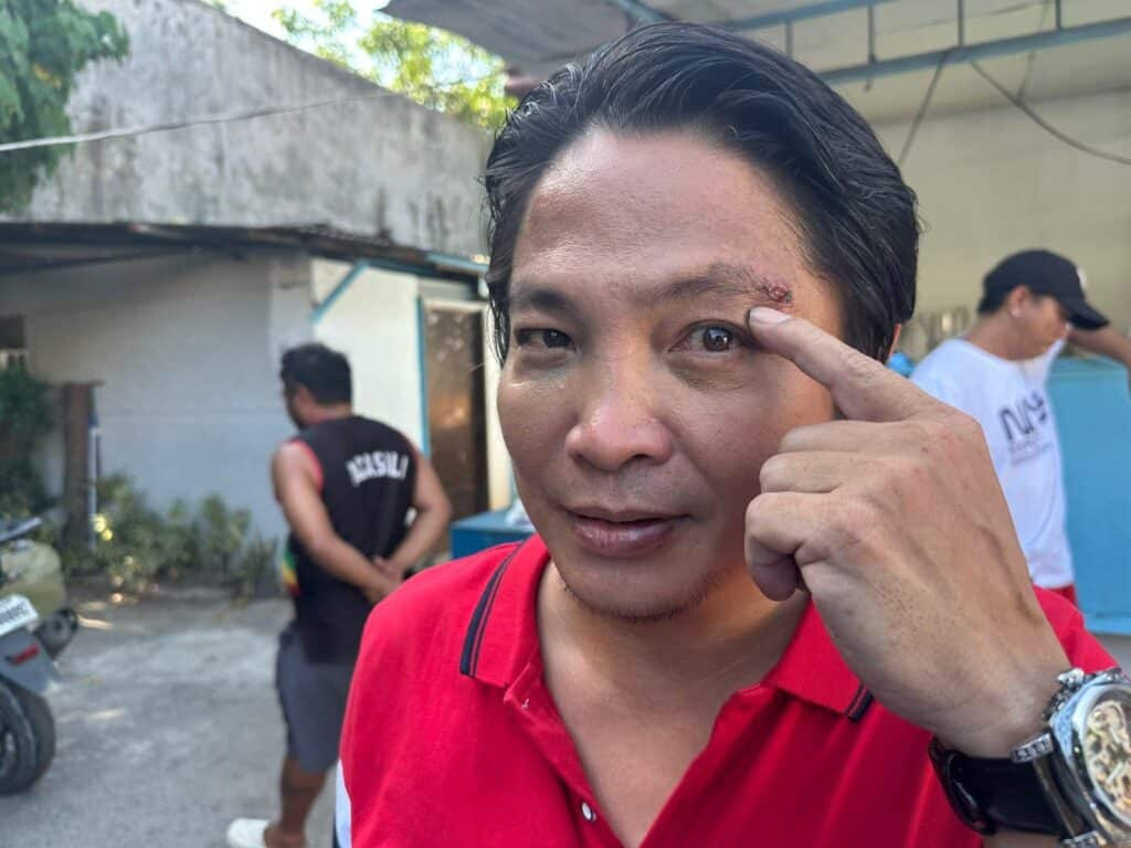 Barangay councilor mauled over political dispute in Mandaue City | Cebu ...