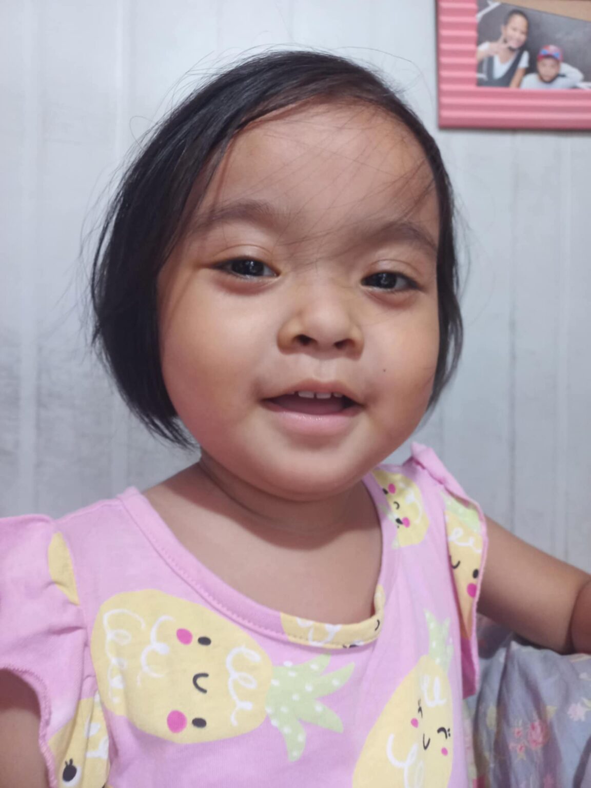 Little Akeisha Needs Help for Chemotherapy | Cebu Daily News