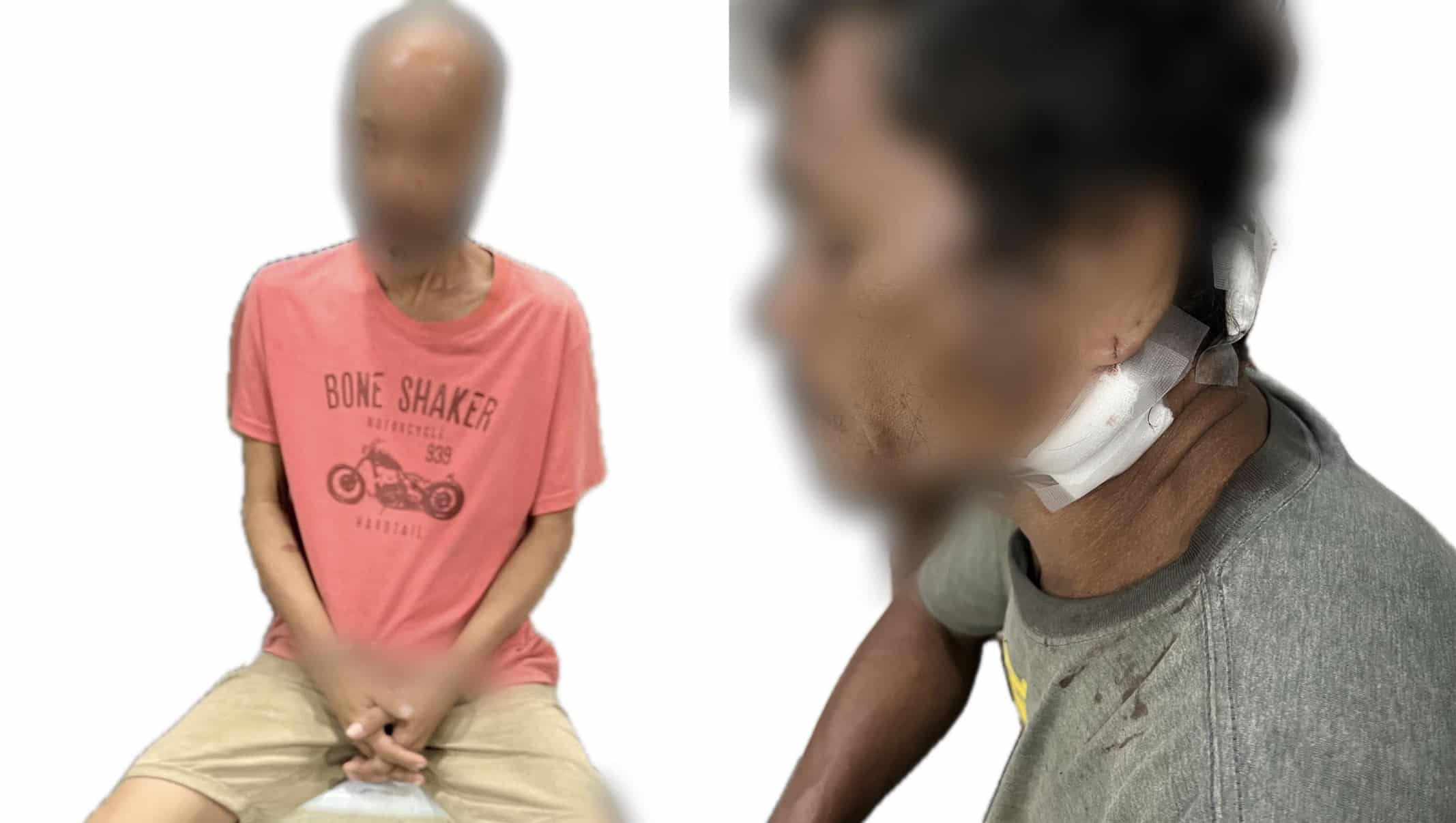 Minglanilla bolo hacking victim drops complaint, settles amicably